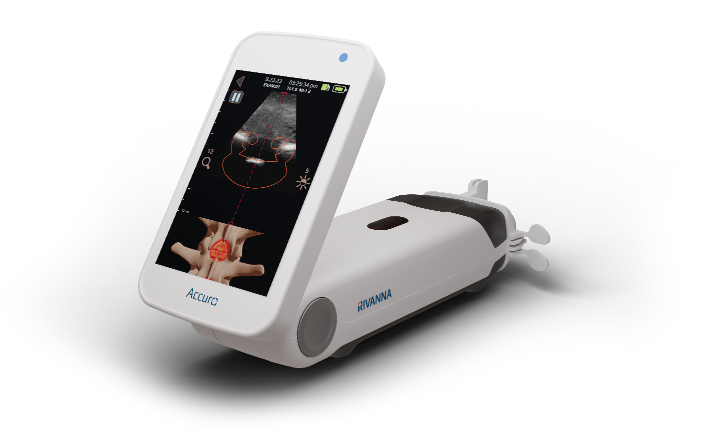 Faster, Easier, Safer Epidurals